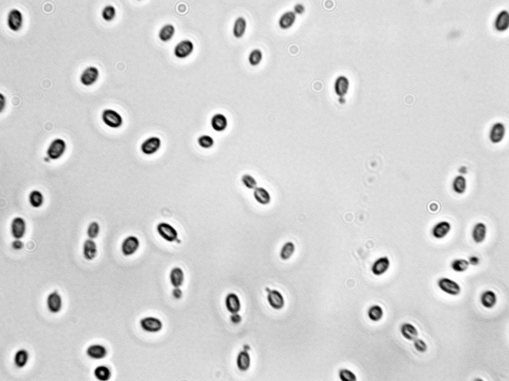 Rhodotorula glutinis « Mycology Culture Collection