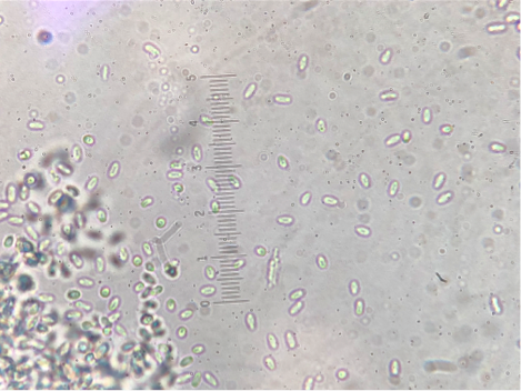 Ampelomyces quisqualis « Mycology Culture Collection