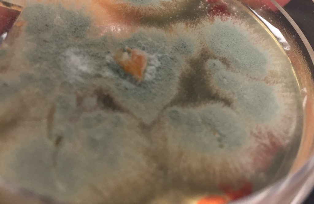 Trichoderma viride « Mycology Culture Collection