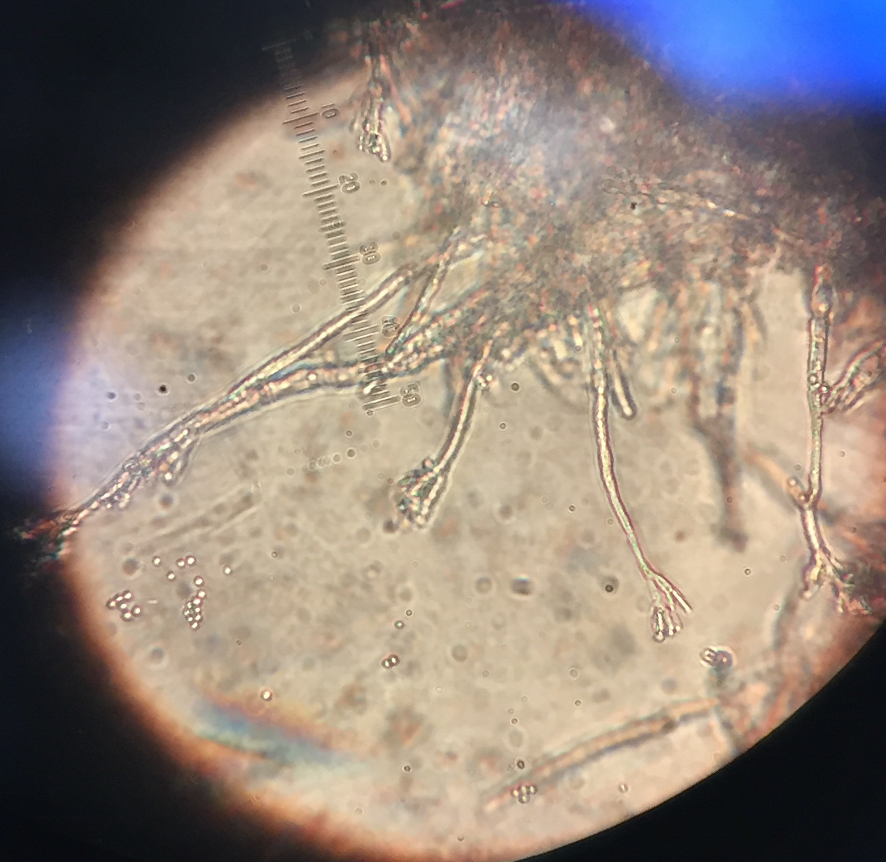 Aspergillus flavus « Mycology Culture Collection