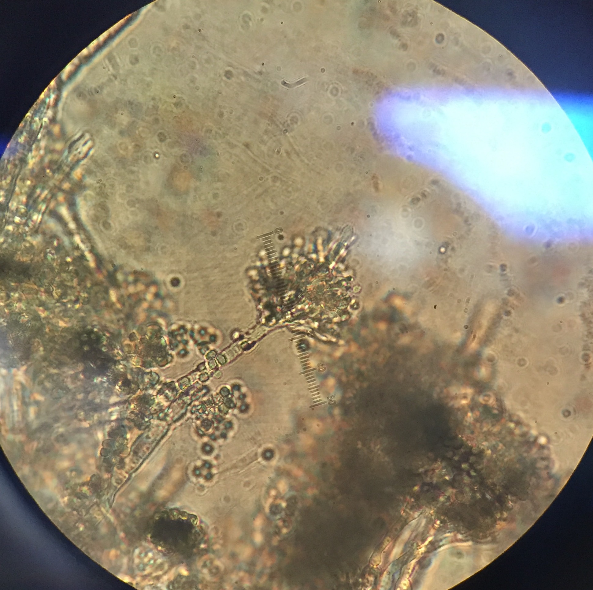 Aspergillus flavus « Mycology Culture Collection