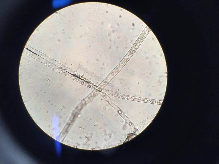 Mucor miehei « Mycology Culture Collection