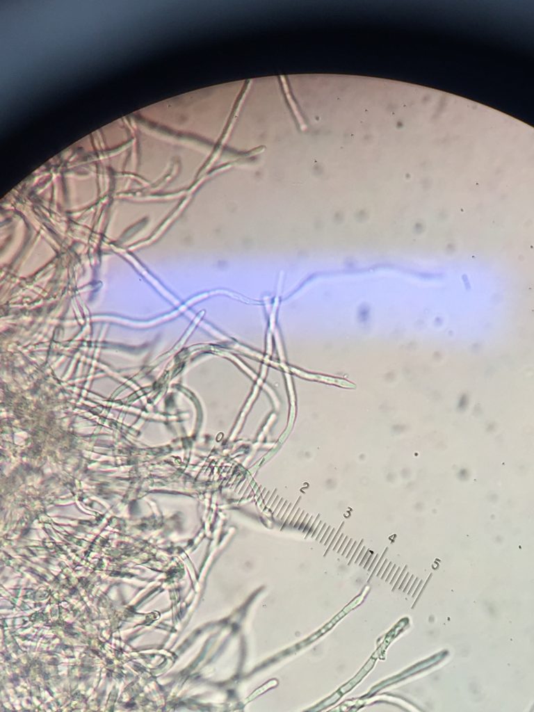 Trichoderma « Mycology Culture Collection