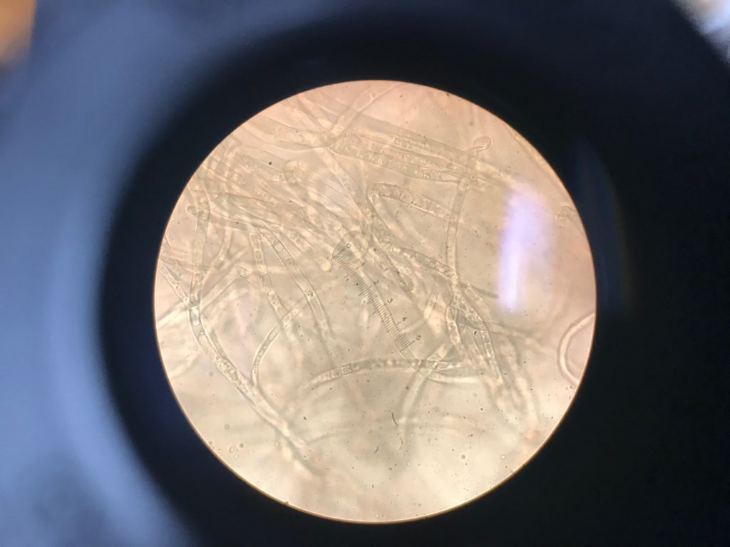 Botrytis sp. « Mycology Culture Collection