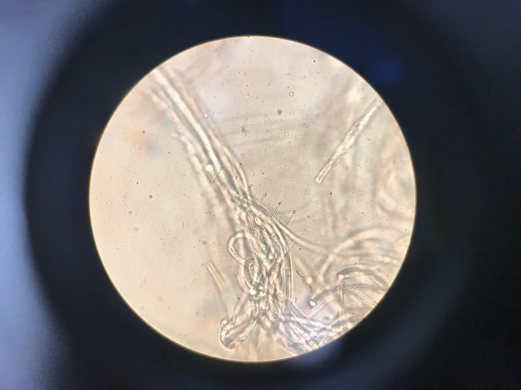 Botrytis sp. « Mycology Culture Collection