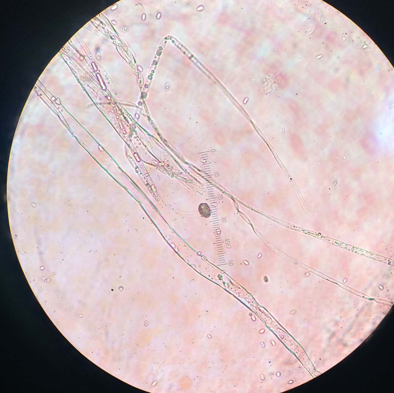 Absidia sp. « Mycology Culture Collection