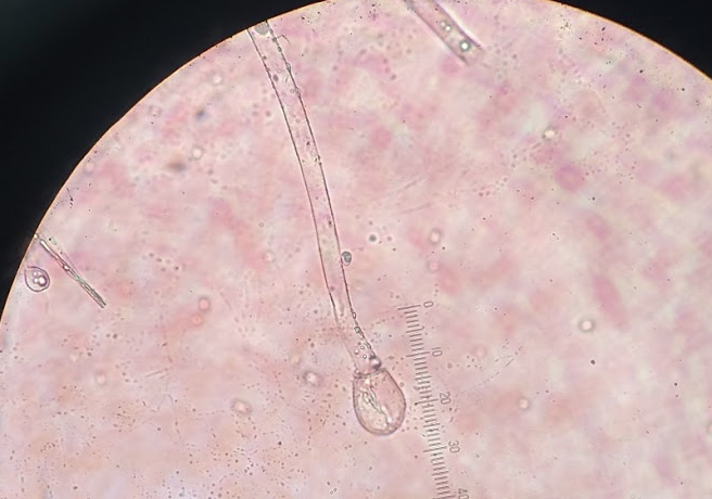 Absidia sp. « Mycology Culture Collection