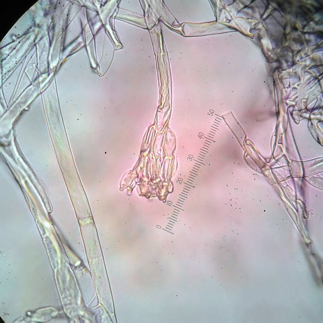 Penicillium sp. « Mycology Culture Collection