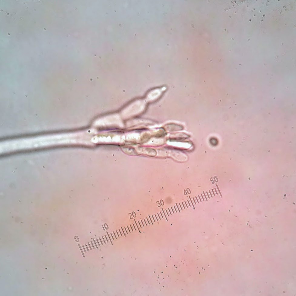 Penicillium sp. « Mycology Culture Collection