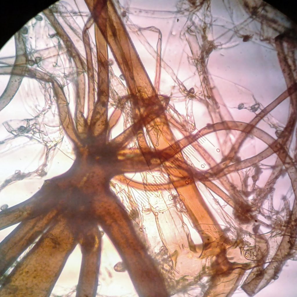 Rhizpous stolonifer « Mycology Culture Collection