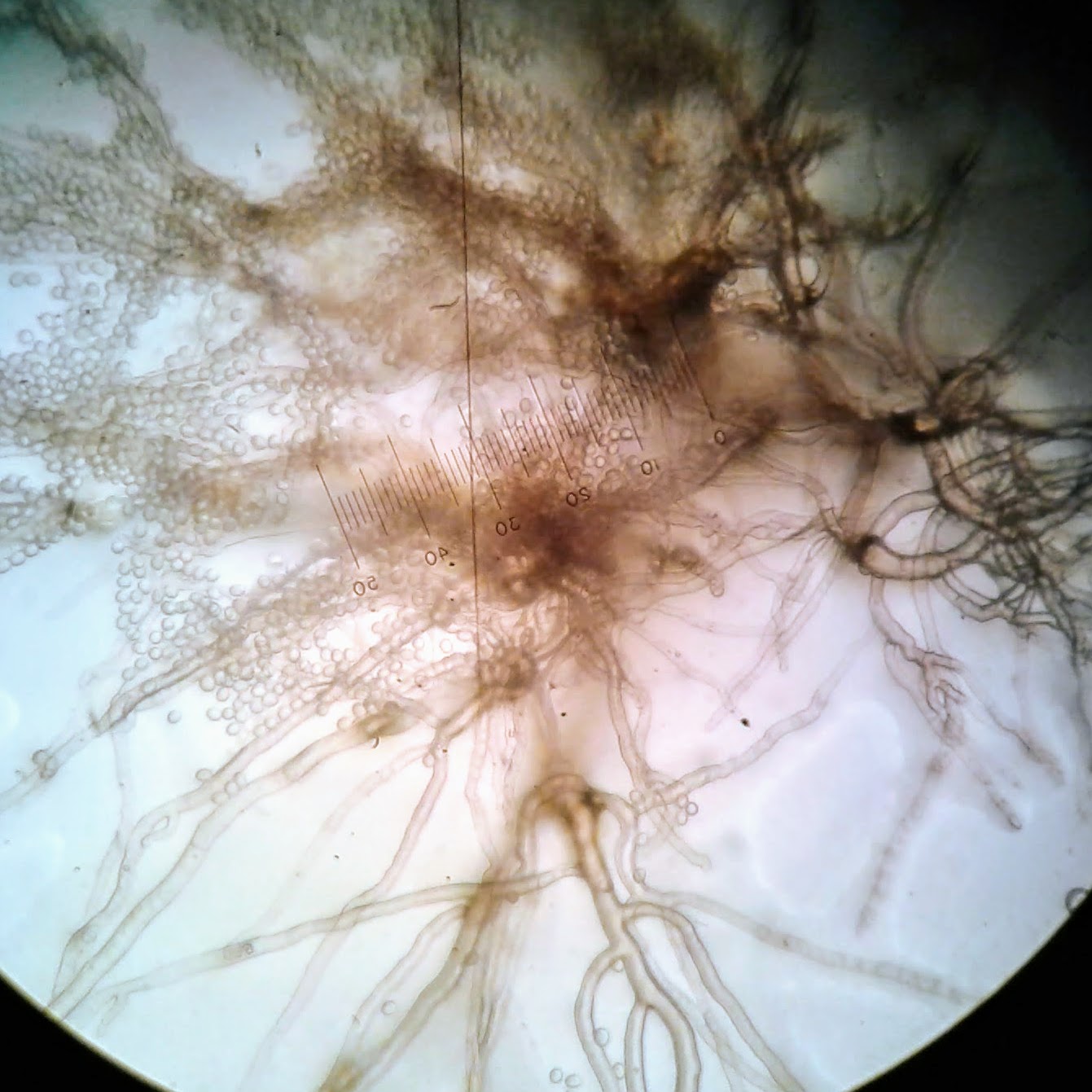 Rhizpous stolonifer « Mycology Culture Collection